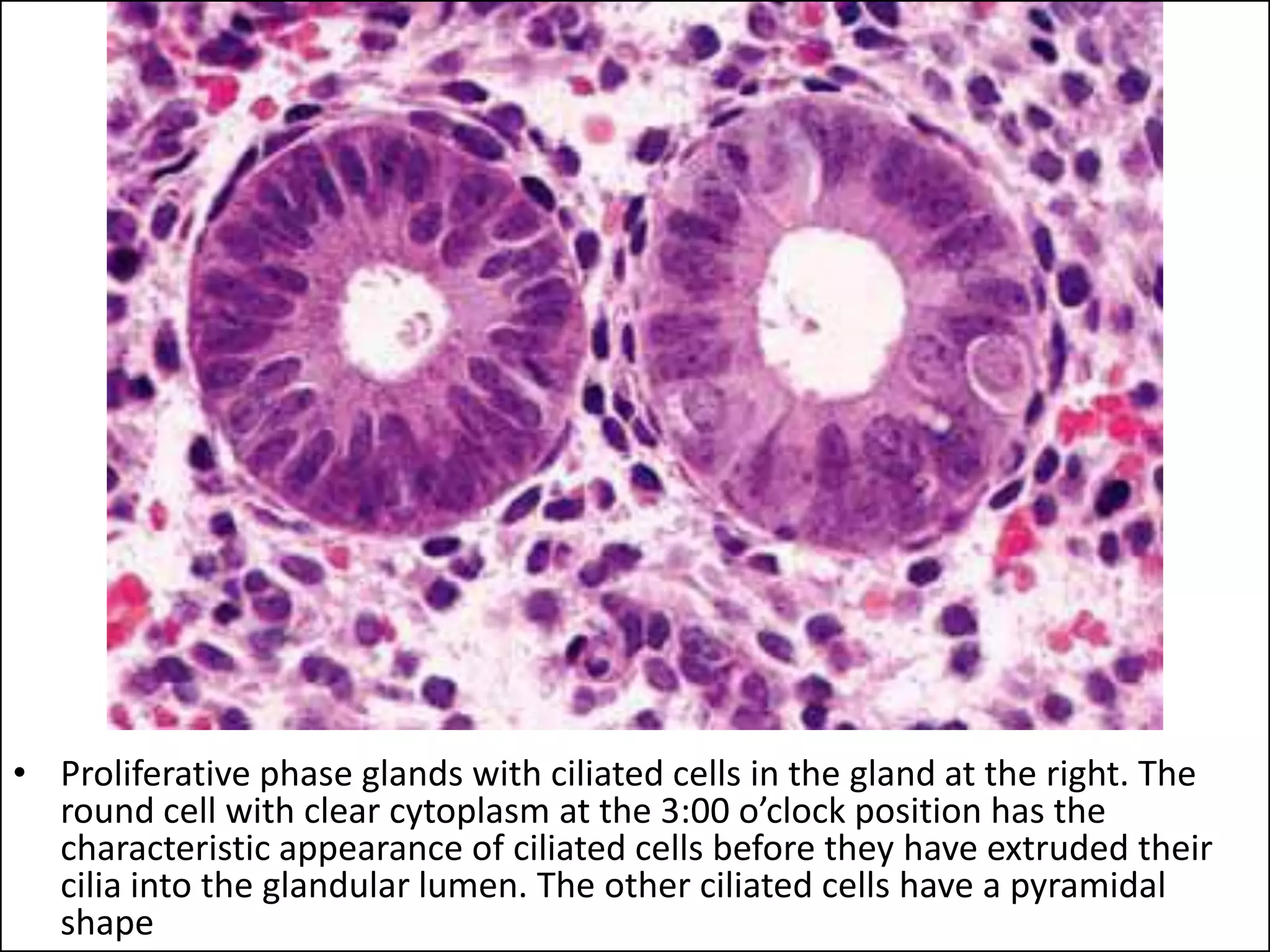 Endometrial histopathology-Basics | PDF