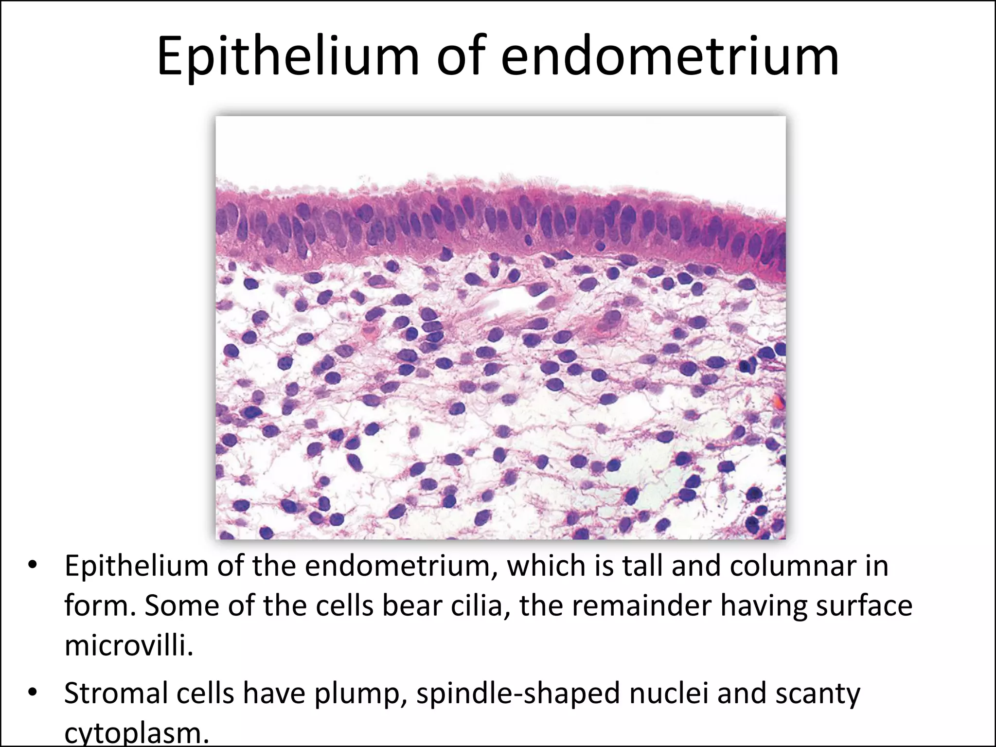 Endometrial histopathology-Basics | PDF