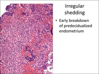 Proliferative Endometrium Histology