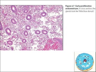 Proliferative Endometrium Histology
