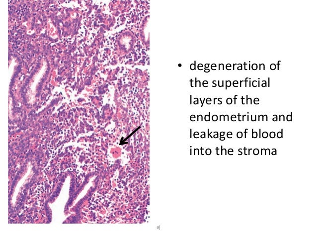 Endometrial histopathology-Basics