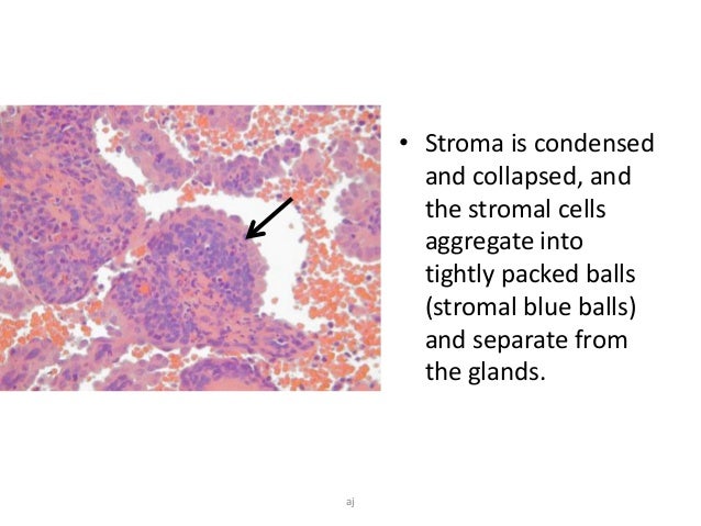 Endometrial histopathology-Basics