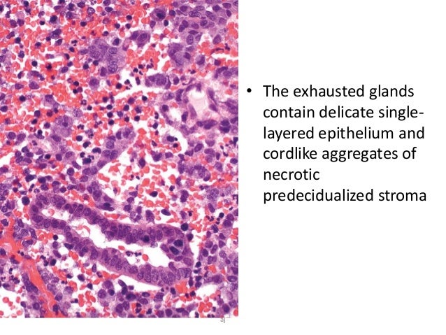 Endometrial histopathology-Basics
