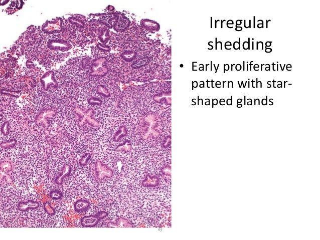 Endometrial histopathology-Basics