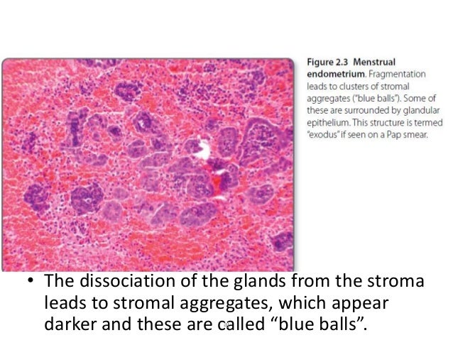 Endometrial histopathology-Basics