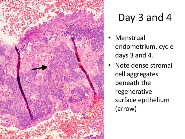 Endometrial histopathology-Basics