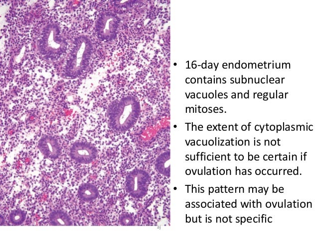 Endometrial histopathology-Basics