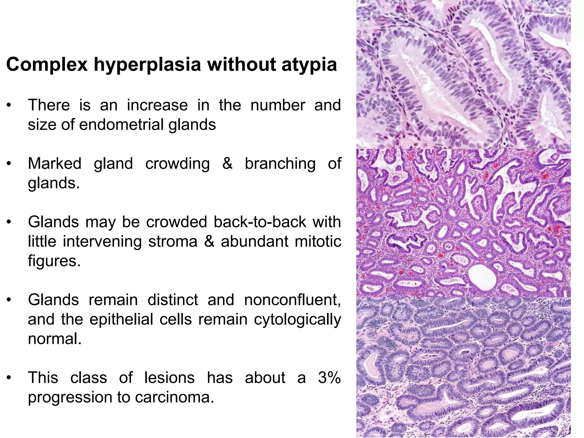 Endometrial hyperplasia | PPTX