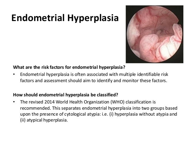 Endometrial Hyperplasia