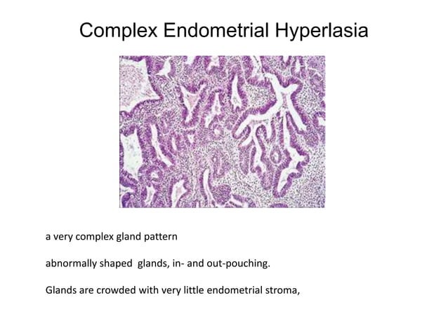 Endometrial hyperplasia.ppt | Menopause | Endocrine and Metabolic Diseases