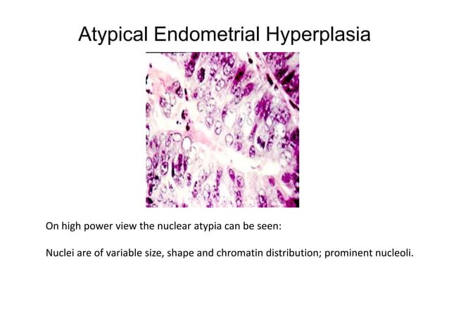 Endometrial hyperplasia.ppt | Menopause | Endocrine and Metabolic Diseases
