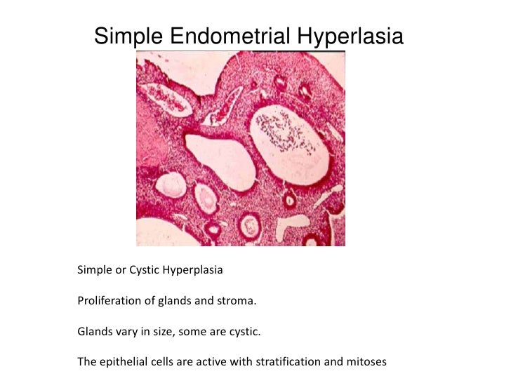 Endometrial hyperplasia.ppt