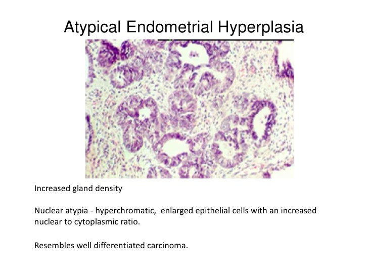 Endometrial hyperplasia.ppt