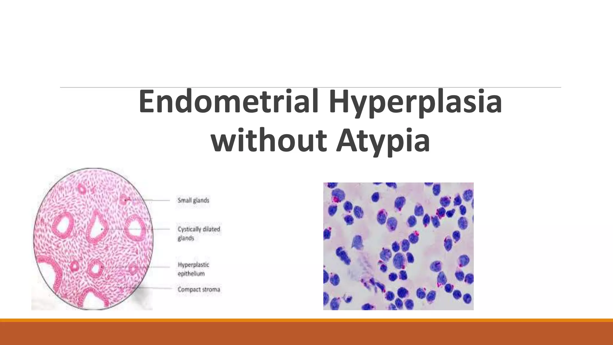 Endometrial Hyperplasia & Cancer Uterus Explain by Dr. Laxmi Shrikhande | PPT