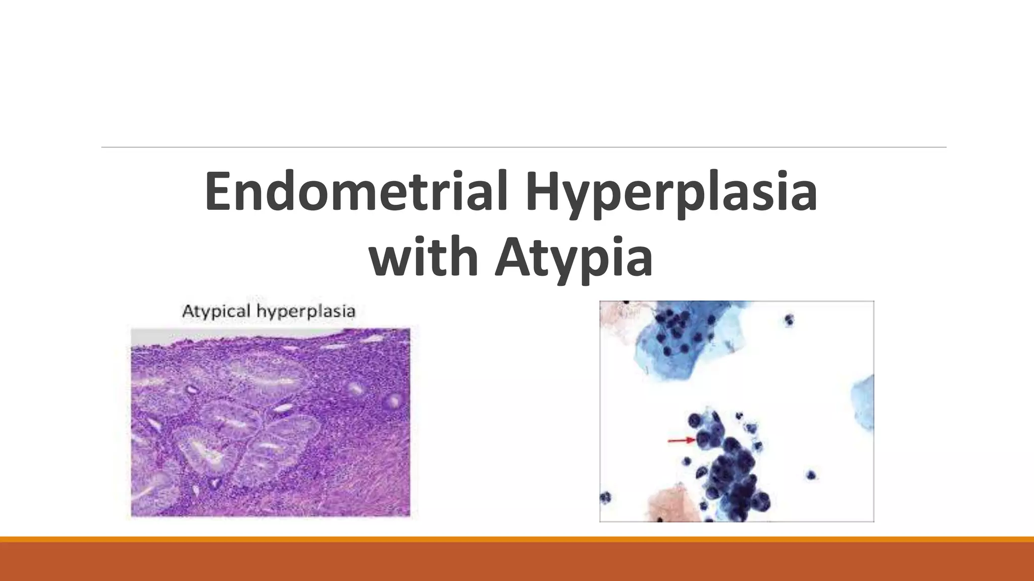 Endometrial Hyperplasia & Cancer Uterus Explain by Dr. Laxmi Shrikhande | PPT