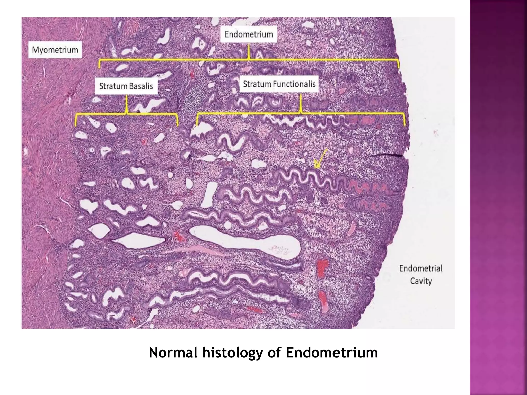 endometrium pathology | PPTX