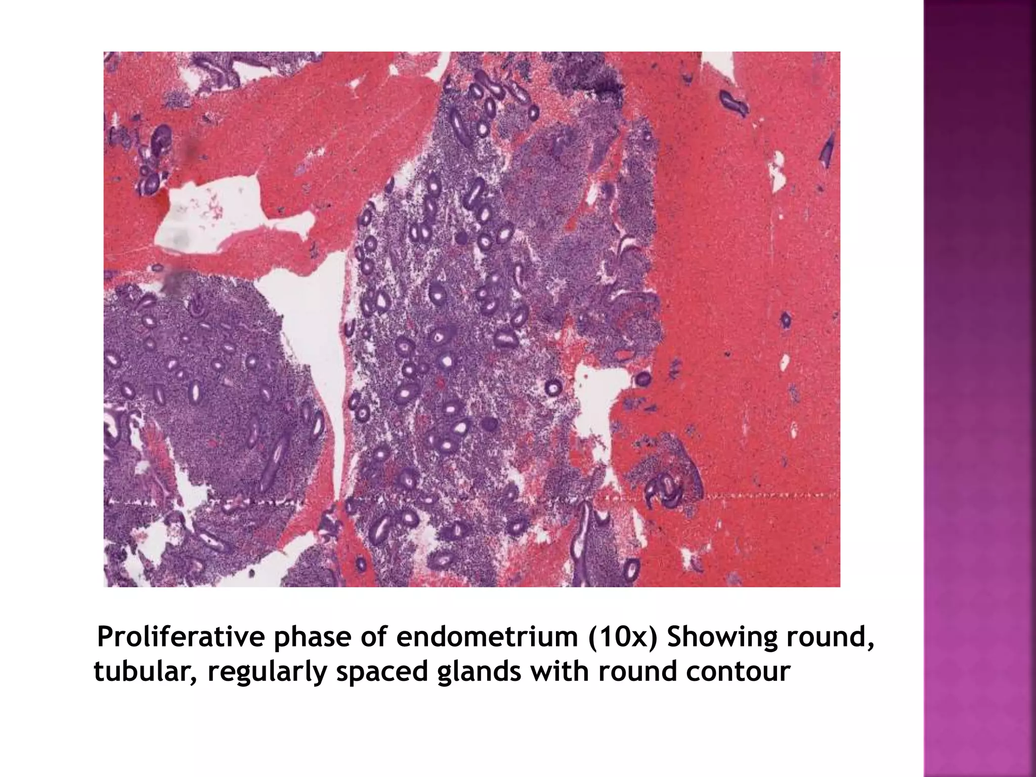 endometrium pathology | PPTX