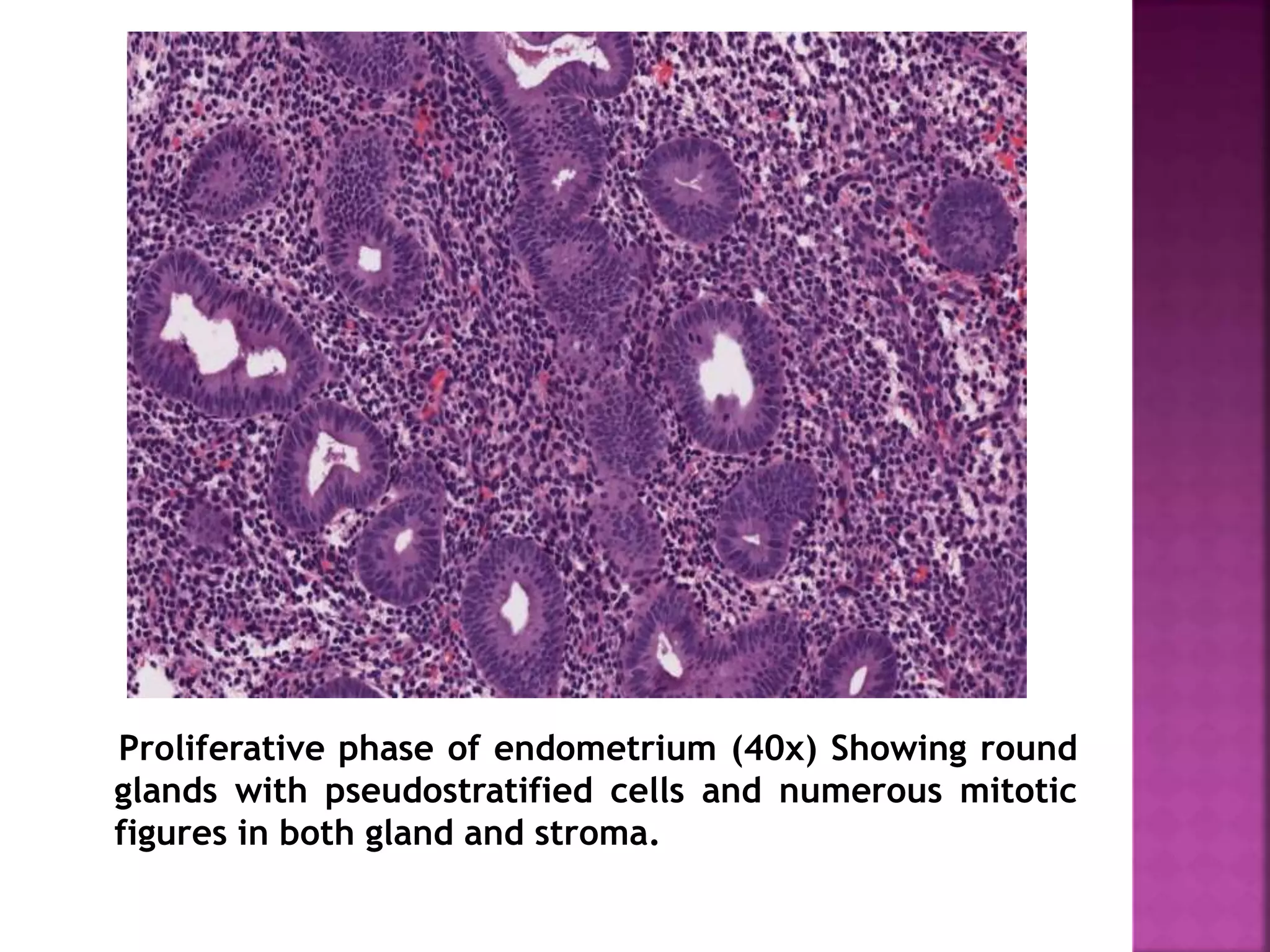 endometrium pathology | PPTX