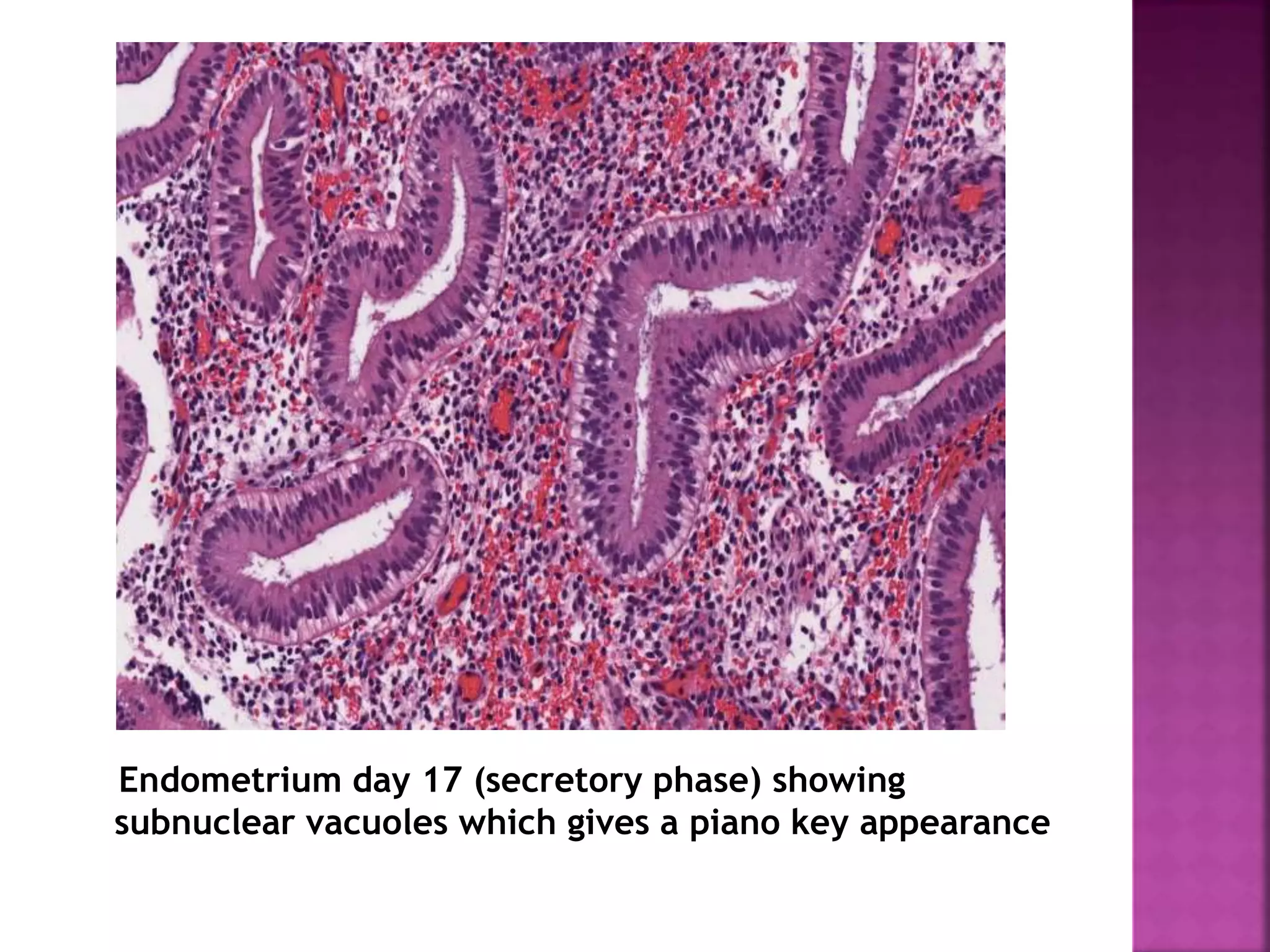 endometrium pathology | PPTX