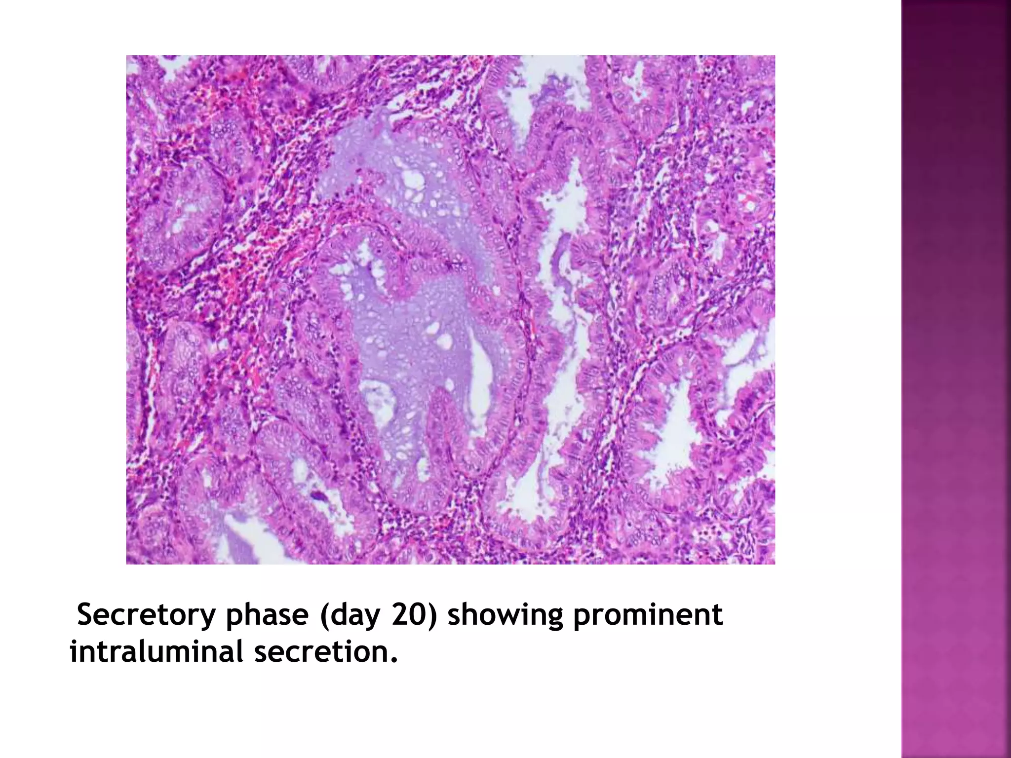 endometrium pathology | PPTX