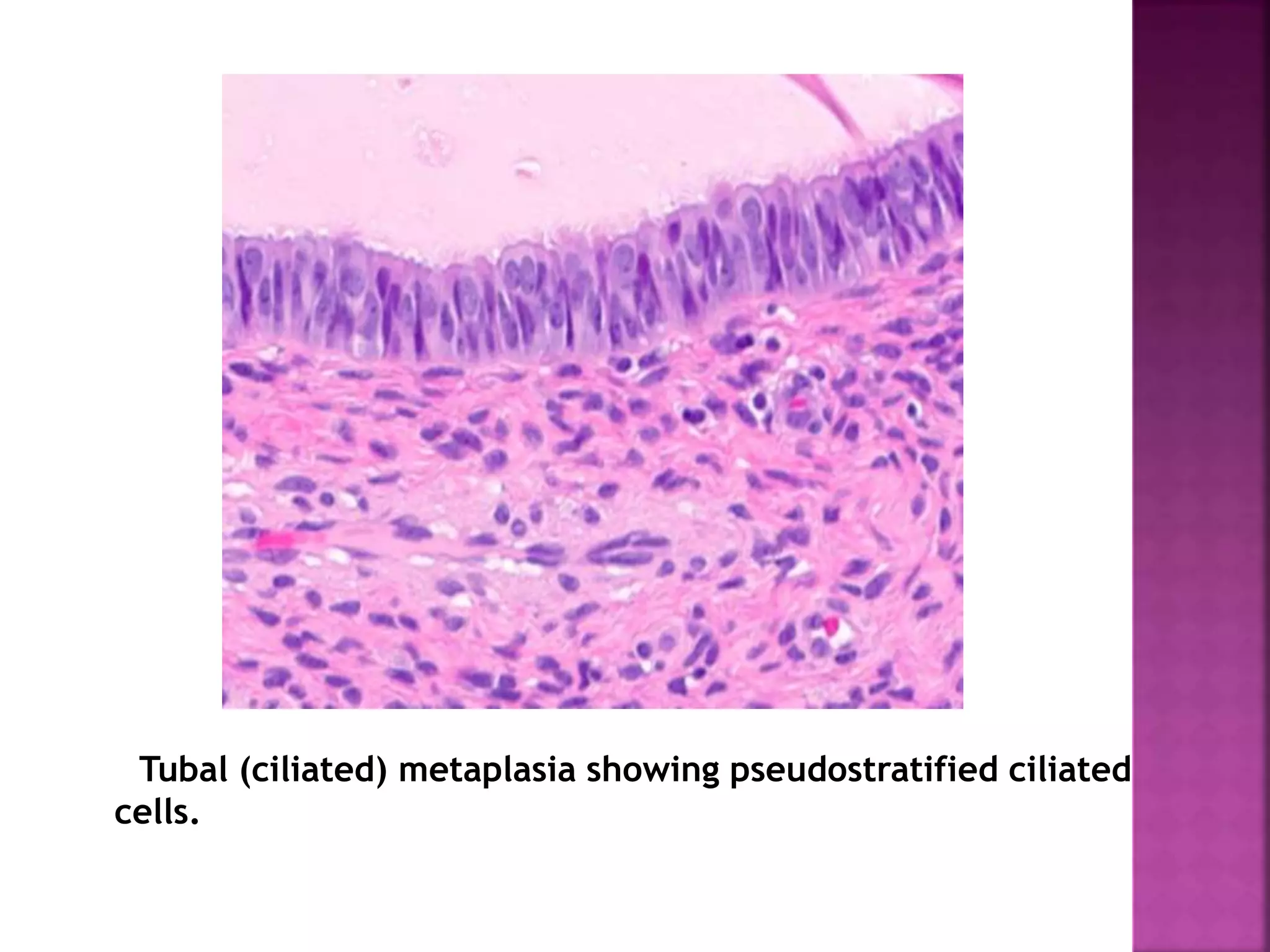 endometrium pathology | PPTX