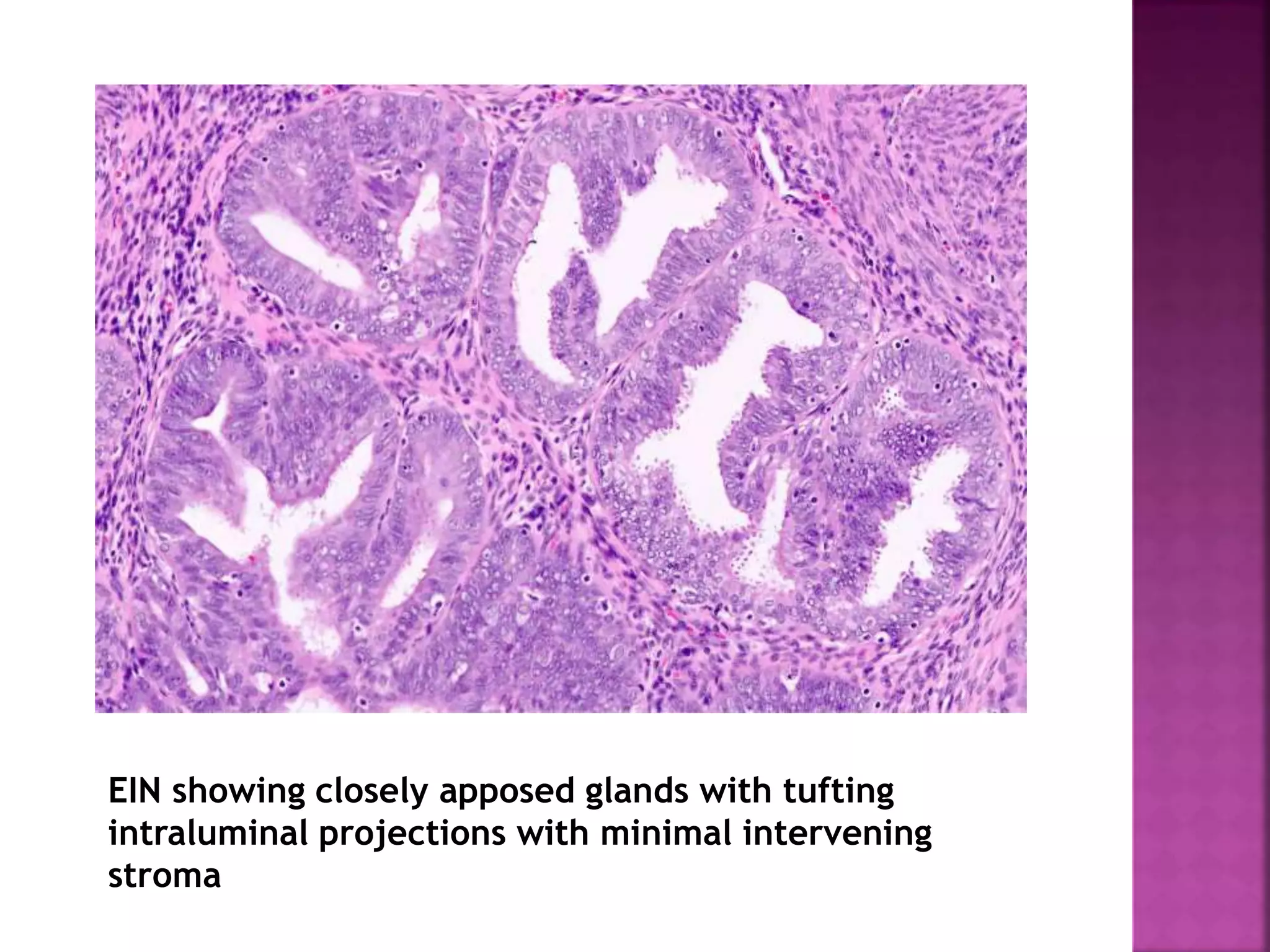 endometrium pathology | PPTX