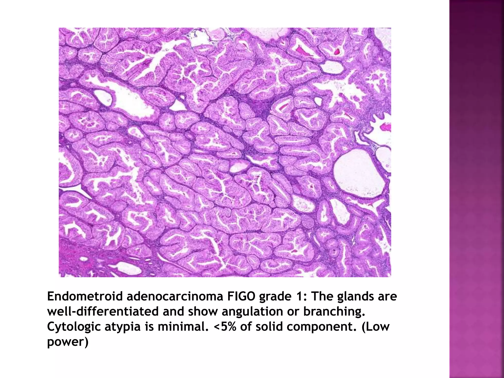 endometrium pathology | PPTX
