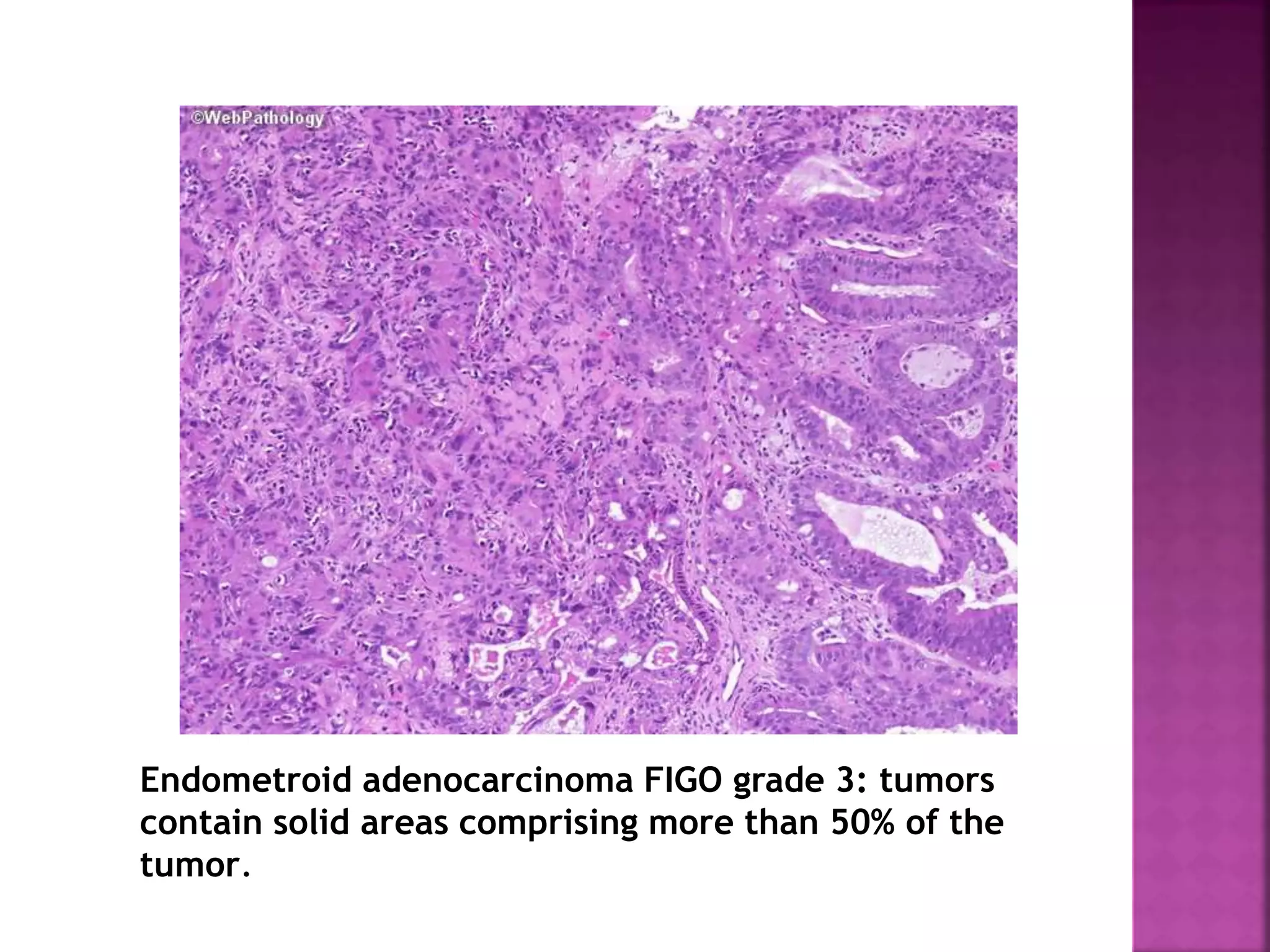 endometrium pathology | PPTX