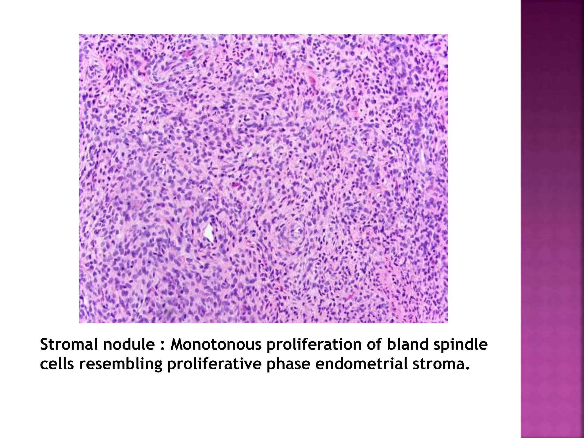 endometrium pathology | PPTX