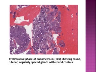 endometrium pathology | PPTX