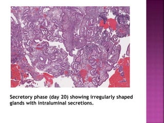 endometrium pathology | PPTX
