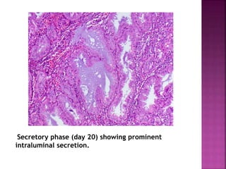 endometrium pathology | PPTX