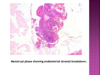 endometrium pathology | PPTX