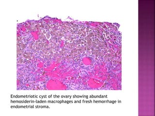 endometrium pathology | PPTX