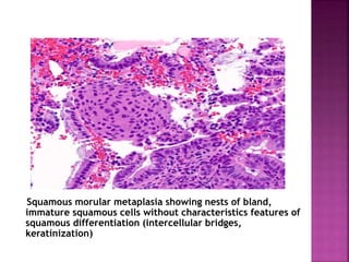 endometrium pathology | PPTX