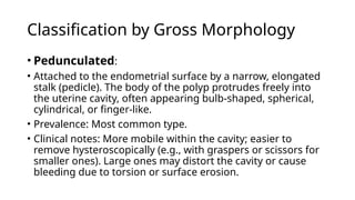 endometrial polyps_Nash Aakash 524B.pptx