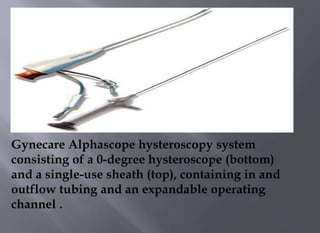 The management of endometrial polyps in the 21st century | PPTX