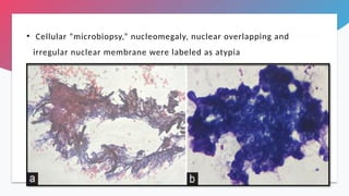 Endometrial Secrets Unmasked through Cytology Analysis ppt - Copy.pptx