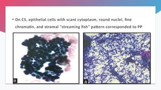 Endometrial Secrets Unmasked through Cytology Analysis ppt - Copy.pptx