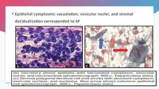 Endometrial Secrets Unmasked through Cytology Analysis ppt - Copy.pptx