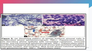 Endometrial Secrets Unmasked through Cytology Analysis ppt - Copy.pptx