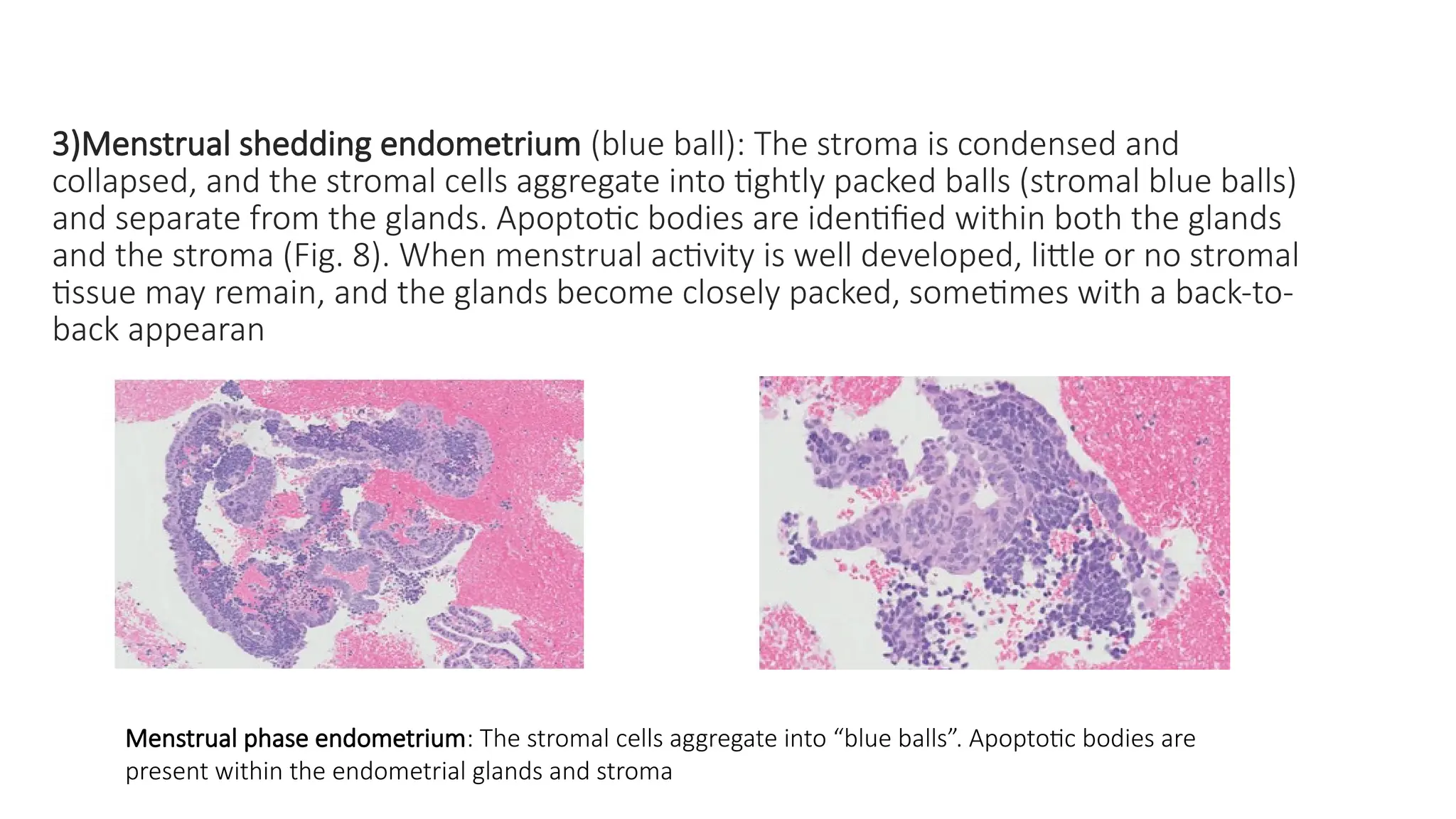 ENDOMETRIAL TUMOUR NEW.pptx download ppt | PPTX