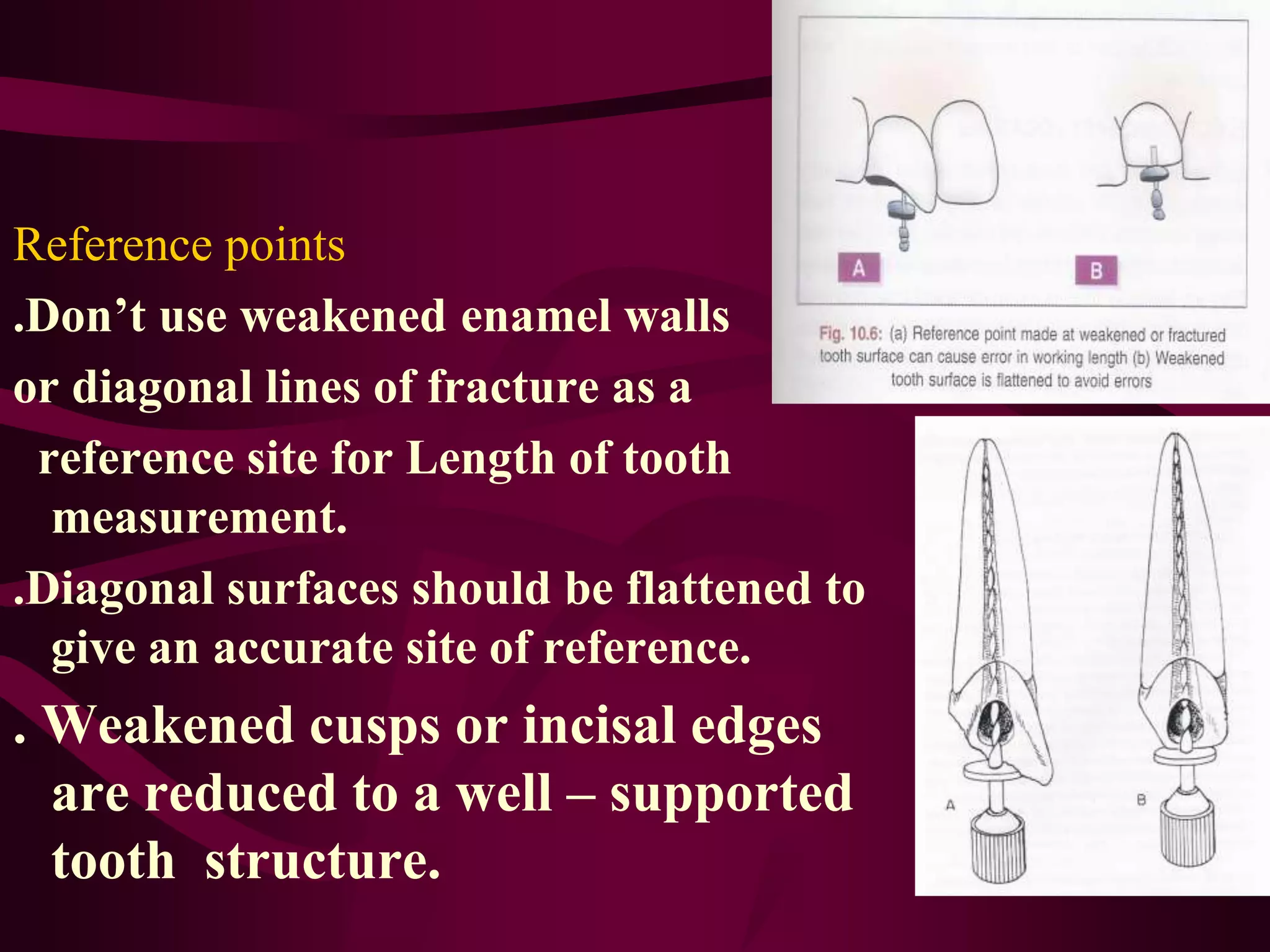 working length estimation in endodontic | PPTX