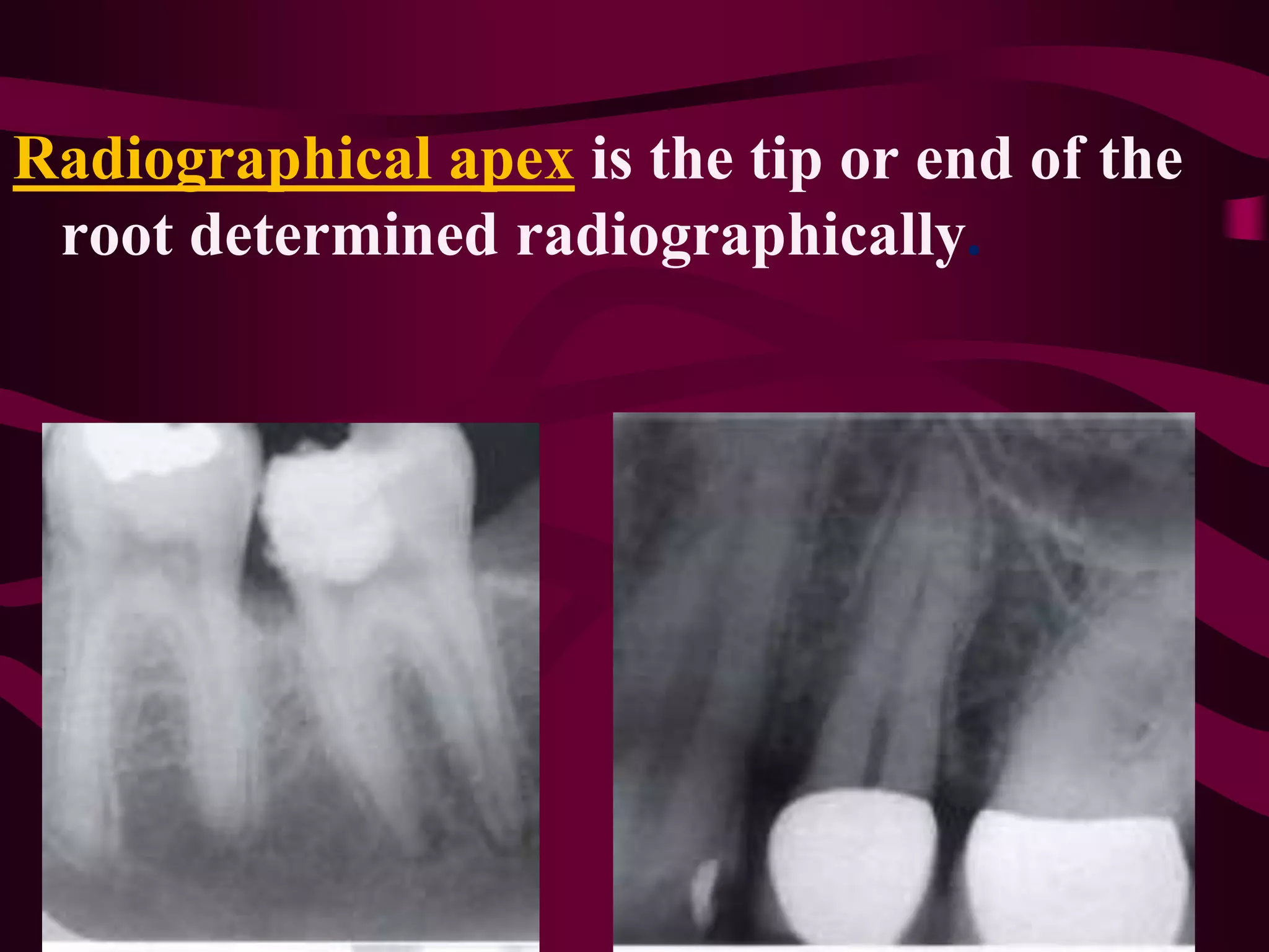 working length estimation in endodontic | PPTX
