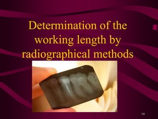 working length estimation in endodontic | PPTX