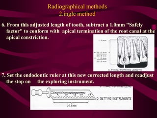 working length estimation in endodontic | PPTX
