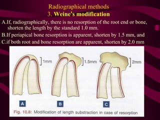 working length estimation in endodontic | PPT