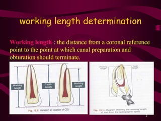 working length estimation in endodontic | PPTX