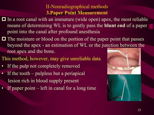 working length estimation in endodontic | PPTX