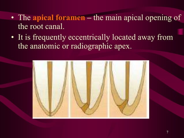 working length estimation in endodontic | PPTX